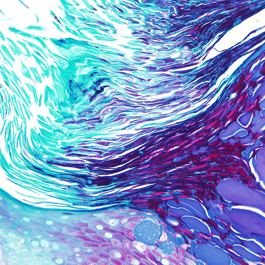 Department of Pathology - “Pathology as Art” Needed for Display at ...